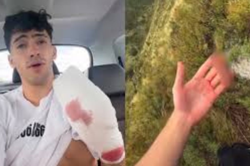 Impactante: el influencer Gero Arias terminó con dos dedos amputados ...